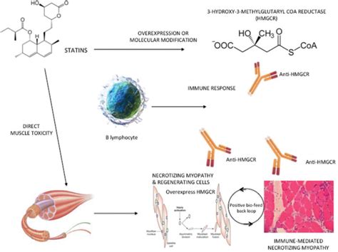 Statin Induced Myalgia And Myositis An Update On Pathogenesis And