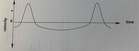 Solved The Following Figure Shows The Radial Velocity Curve