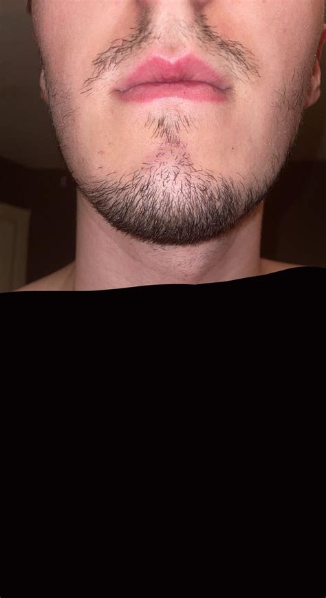 Hello This Is What My Beard Looks Like After 2 Weeks Of Growth At 19yo