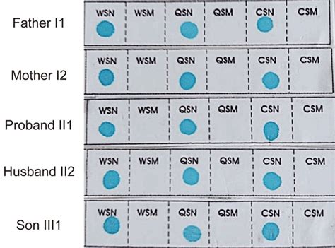 Reverse Dot Blot Hybridization Rdbh Assay Analysis Of The α Qs α α