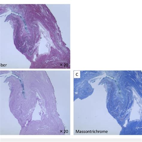 Pdf The First Histological Analysis Of The Tissues Lining The Fossa