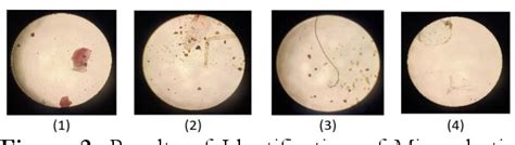 Figure From Microplastics In Sediment Of Indonesia Waters A Systematic Review Of Occurrence