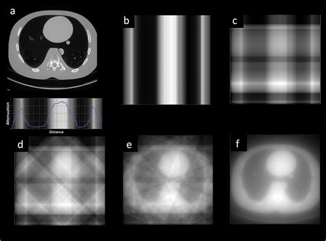 Image Reconstruction Part 1 Understanding Filtered Back Projection Noise And Image