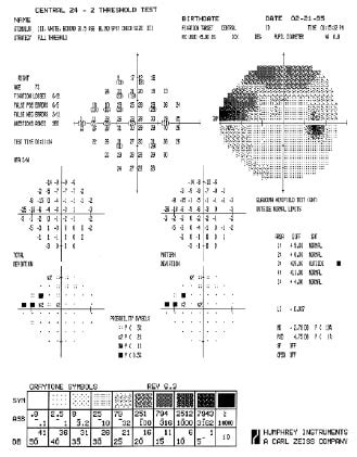 Avoiding Fixation Losses In Visual Fields Testing Ophthalmic Professional