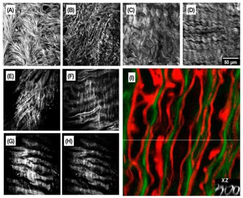 Optical Microscopy And The Extracellular Matrix Structure A Review