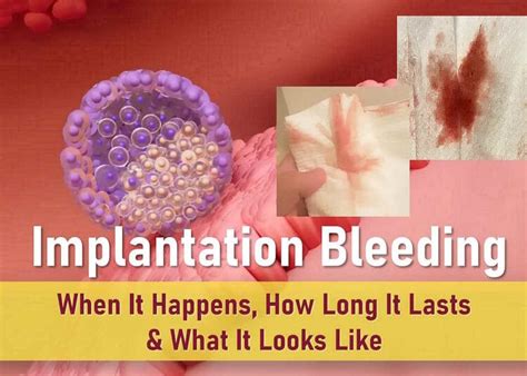Implantation Bleeding When It Happens How Long It Lasts What It Looks Like