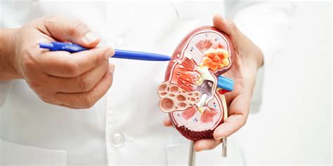 What Is Diabetes Nephropathy Fitterfly
