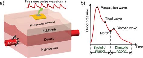 Wearable PZT Piezoelectric Sensor Device for Accurate Arterial Pressure ...