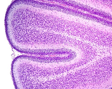 Granular Layer Stock Illustrations 792 Granular Layer Stock