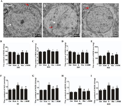 Figure 1 From The Activation Of Gabaar Alleviated Cerebral Ischemic