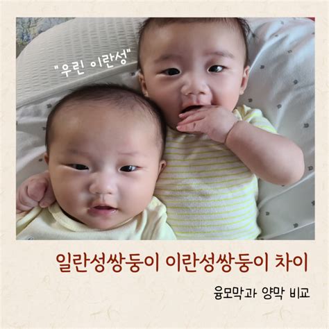일란성쌍둥이 이란성쌍둥이 차이점 융모막 양막 비교 네이버 블로그