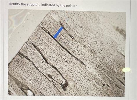 solved identify the structure indicated by the pointer
