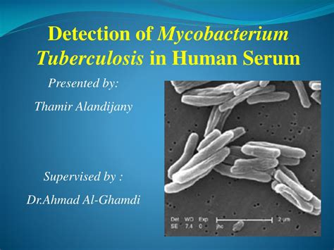 Ppt Detection Of Mycobacterium Tuberculosis In Human Serum Powerpoint