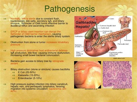 Ppt Cholangitis And Management Of Choledocholithiasis Powerpoint Presentation Id 4488108