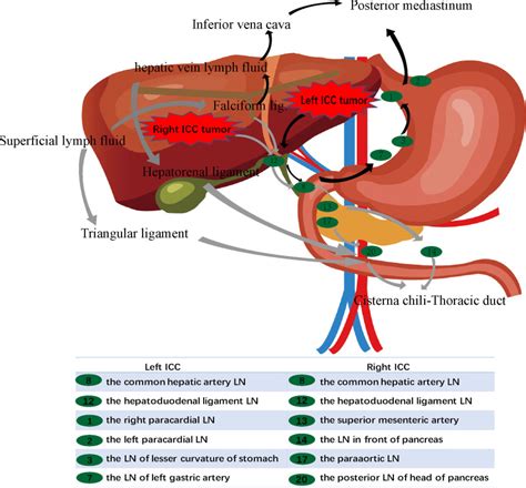 Lymph Node Metastasis Of Intrahepatic Cholangiocarcinoma The Present
