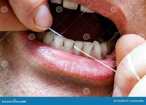 Man Cleans Teeth With Dental Floss Oral Hygiene Stock Photo Image Of Hygiene Floss 232302218