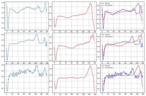 Sensors Free Full Text Attention Autoencoder For Generative Latent