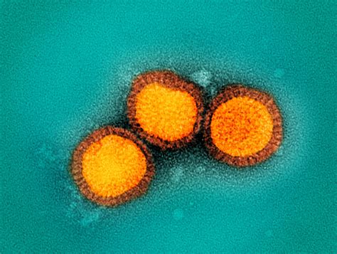 Using Mrna Technology For A Universal Flu Vaccine National Institutes