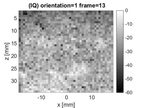 4 A Frame Of Beamformed Data Left And A Frame Of The Velocity Field