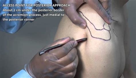 Injection Technique Download Scientific Diagram