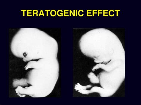 Ppt Effect Of Maternal Drugs On Fetus Powerpoint Presentation Id727467