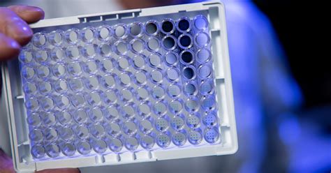 multiplex micro array services future diagnostics