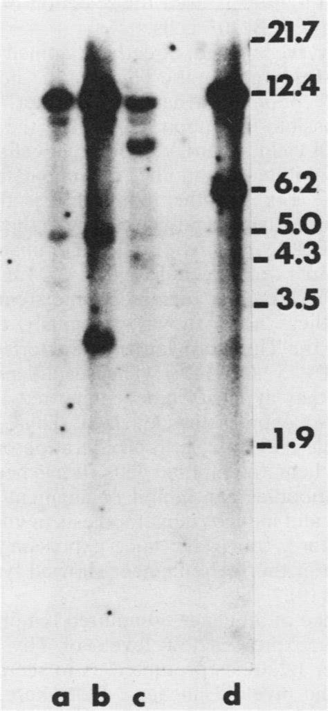 Identification Of A Novel Bone Marrow Derived B Cell Progenitor Population That Coexpresses B220