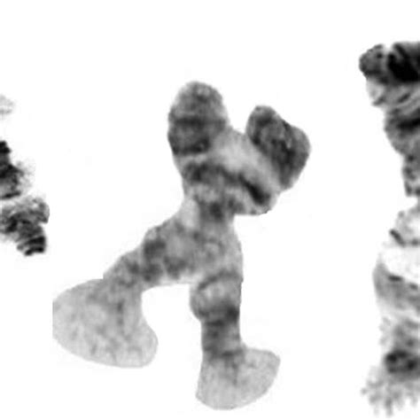 Inversion Sequences Of Chromosome Iv G Glyptotendipes Glaucus Download Scientific Diagram