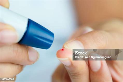 의사는 여성의 손에 당뇨병을 검사하고 디지털 혈당 측정기로 당뇨병과 고혈당 수치를 확인합니다 건강 관리 및 의료 개념 2명에 대한 스톡 사진 및 기타 이미지 Istock