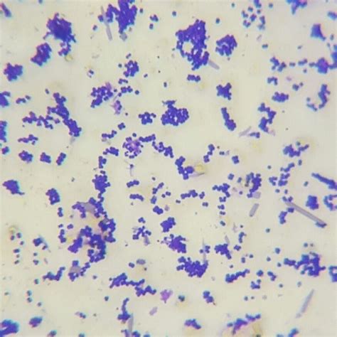 Pediococcus Alchetron The Free Social Encyclopedia