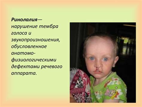 Классификации Ринолалии - презентация онлайн