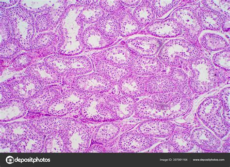 Human Testis Histology