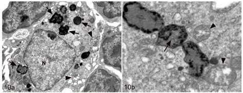 M Microti Tuberculous Lesion In A Field Vole Epithelioid Cell In