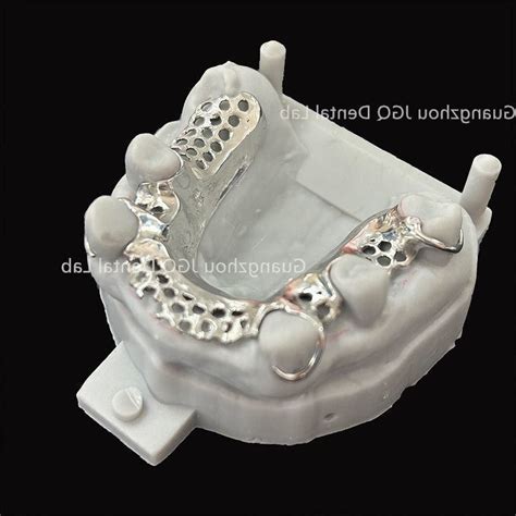China Dental Lab Oem Partial Framework Dentures Highly Popular And