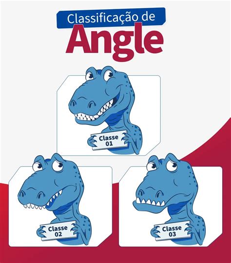 Classificação De Angle Entenda Os Tipos E Diferenças