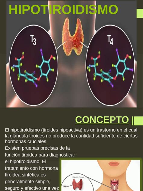Hipotiroidismo Síntomas Y Tratamiento Pdf Hipotiroidismo