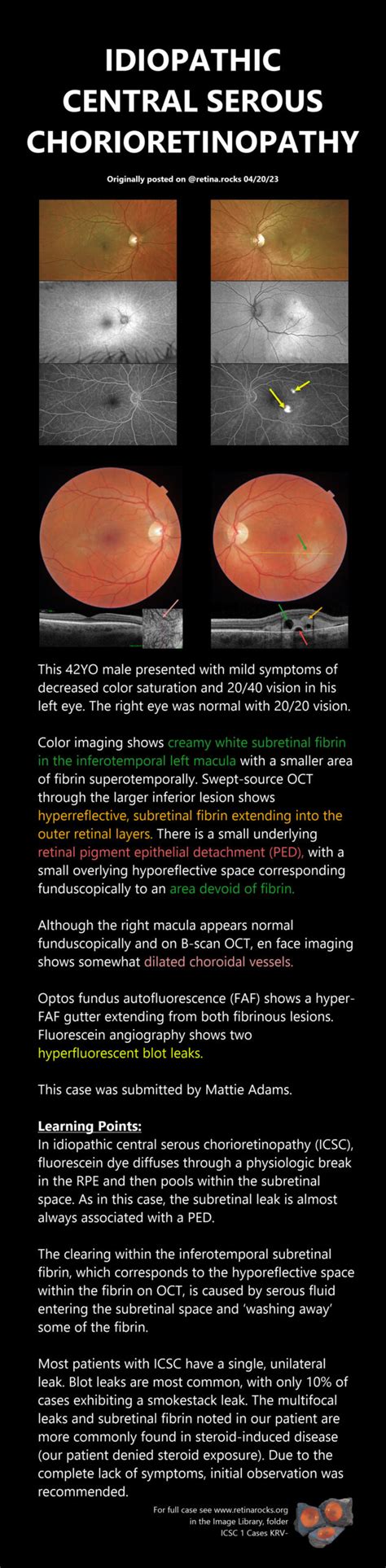 Serous Fluid Color