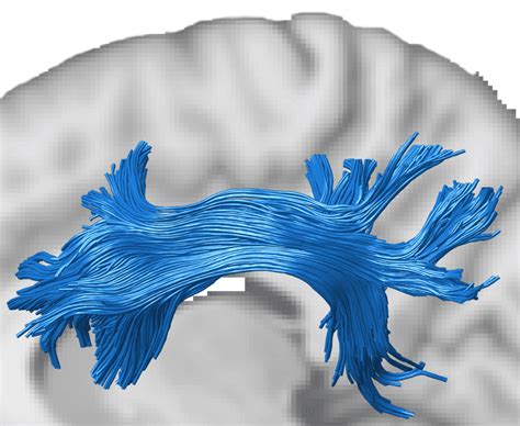 Novel Gpu Based Machine Learning Model Discovers Human Brain