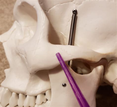 Facial Bones Flashcards Quizlet