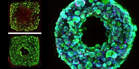 3d Bioprinting For Medical And Enhancement Purpose Geeetech