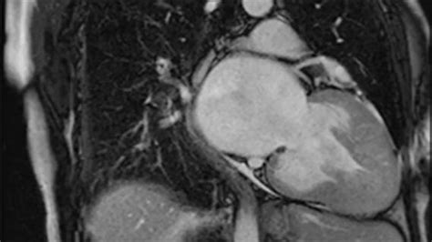 News Releases Cleveland Clinic