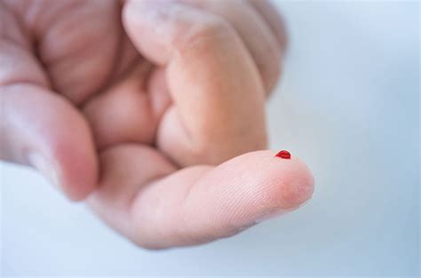 Ini Kondisi Yang Bisa Sebabkan Hemoglobin Rendah