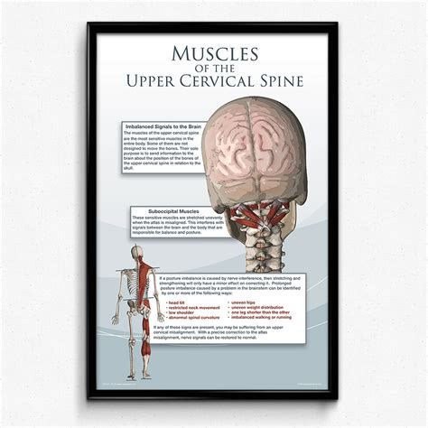Upper Cervical Specific Chiropractic Posters Digital Chiropractic