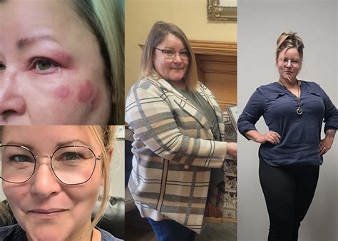 8 Best Beef Tallow Brands For The Carnivore Diet