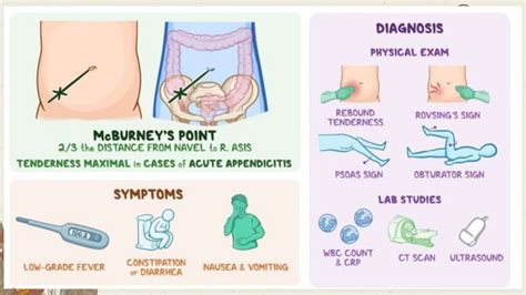 Diagnosa Dan Tatalaksana Appendicitis Akut Pptx