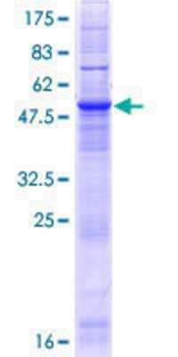 Recombinant Human CLN6 GST (N-Term) Protein (H00054982-P01) by Novus ...