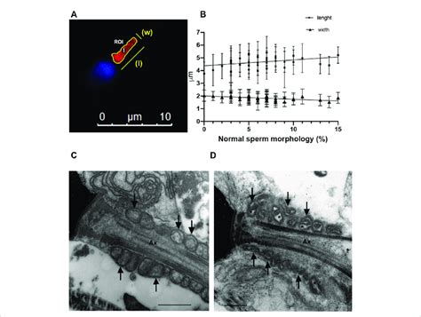 Sperm Morphology Analysis A Epifluorescence Microscopy Of The