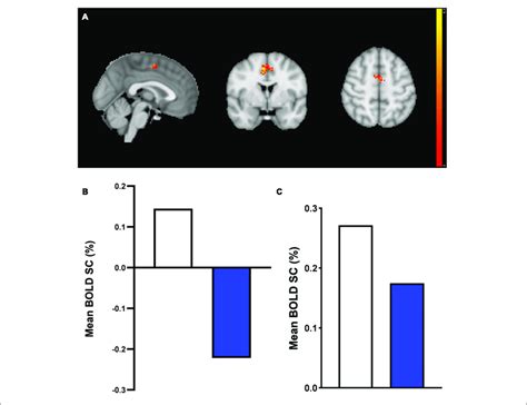 Anterior Cingulate Cortex Region Of Interest Fmri Faces Task Results