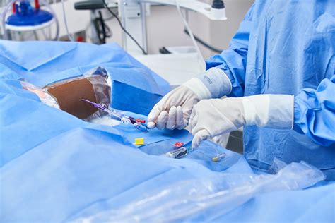 Peripherally Inserted Central Catheters