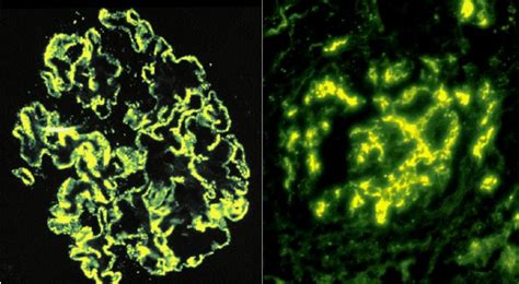 Immunofluorescence Pictures The Left Shows Granular Deposits Along The Download Scientific